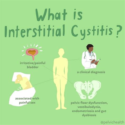 Interstitial Cystitis Also Called Painful Bladder Syndrome