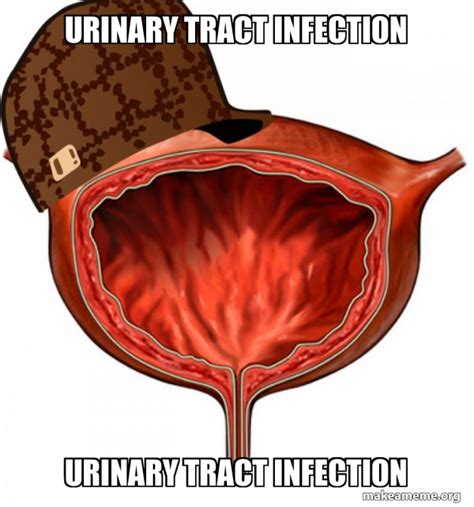 Urinary Tract Infection Urinary Tract Infection Scumbag Bladder Meme