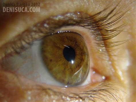 Ochiul Uman De Aproape Denisa Lala