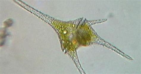 Dinoflagellates Microscope Slide