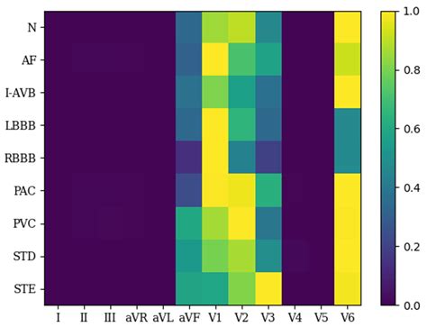visualized lead selection for arrhythmia classification based on a lead