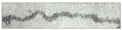 Eucromatina Ed Eterocromatina