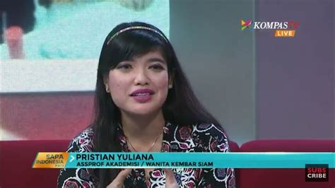 Kisah Yuliana Yuliani Kembar Siam Pertama Yang Berhasil Dipisahkan Hingga Jadi Dokter Dan