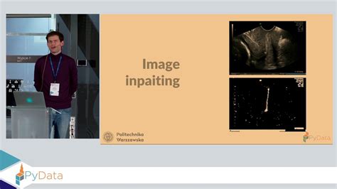 · Predicting Preterm Birth With Convolutional Neural Nets Tomasz Włodarczyk