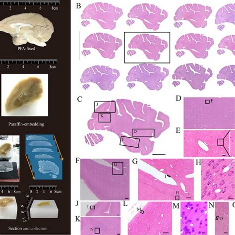 Pdf Paraffin Embedding For Large Volume Bio Tissue