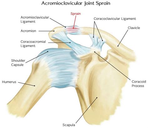 Acromioclavicular Joint Palpation