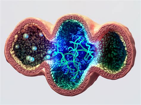 角化型鳞癌病理报告怎么看 角化型鳞癌 鳞状细胞癌 肿瘤疾病大全癌症肿瘤科普知识 有来医生