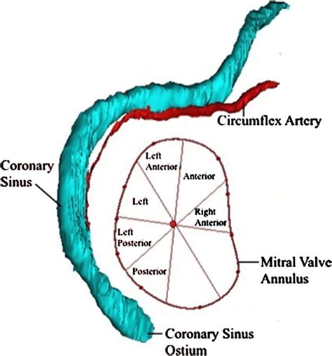 Circumflex Artery