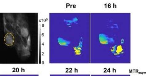 암세포에 많은 과산화수소 감지하는 조영기술 개발