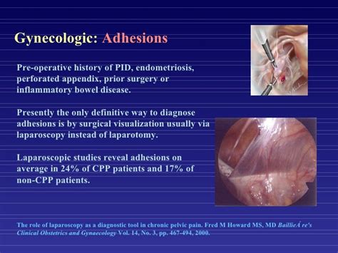 Diagnostic Laparoscopy For Pelvic Disorders