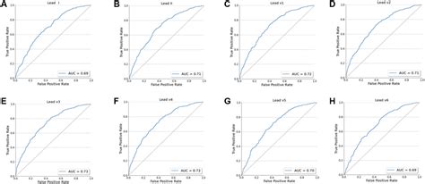 The Feasibility Of Early Detecting Coronary Artery Disease Using Deep