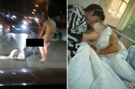 Woman Cuts Cheating Husband S Penis Off Tracks Him Down In Hospital And Cuts It Off Again