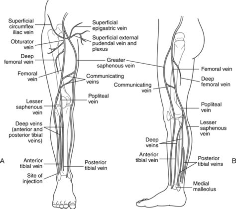 Peripheral Vascular Procedures Radiology Key