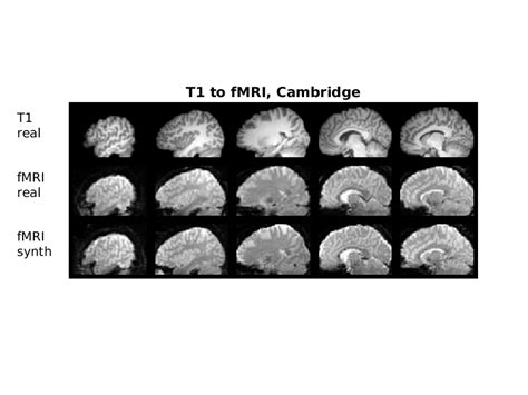 Generating Fmri Volumes From T1 Weighted Volumes Using 3d Cyclegan Deepai