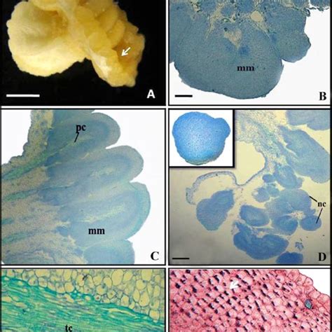 Zygotic Embryo Of E Guineensis At 14 Days Of Cultivation In Somatic