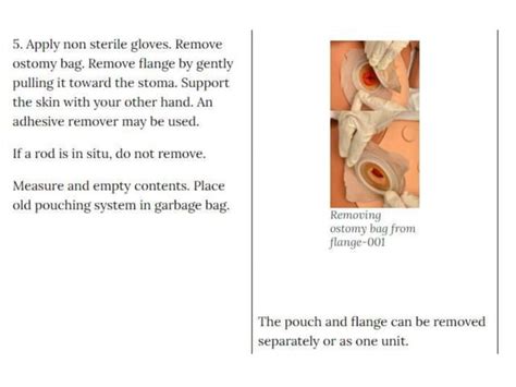 Colostomy Care Application Procedure Pptx