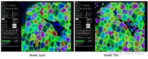 Cellpose 20——利用自己的数据训练模型 知乎