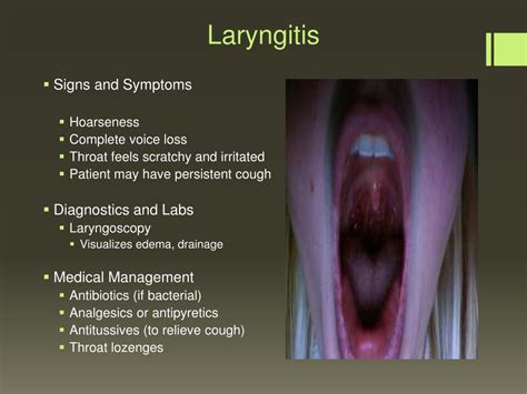 Laryngitis Symptoms Laryngitis Behandlungen Oltxqb