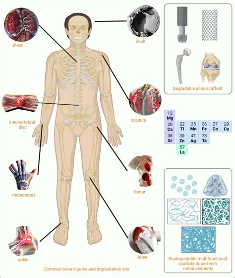 Research Progress In Degradable Metal‐based Multifunctional Scaffolds For Bone Tissue