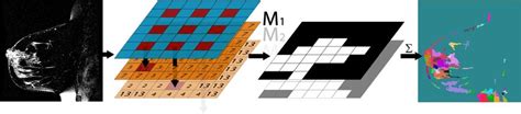 Region Based Segmentation Applied To A Breast Mri Dataset 5