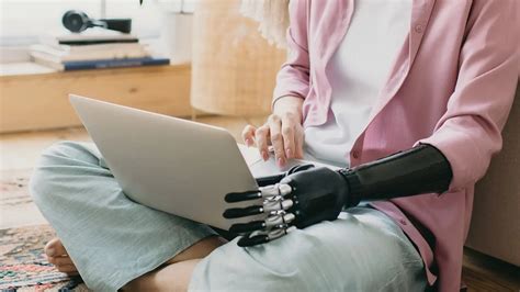 Rehabilitation And Recovery After Amputation A Step By Step Guide