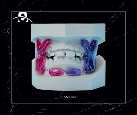 Functional Appliances Fn Orthodontics