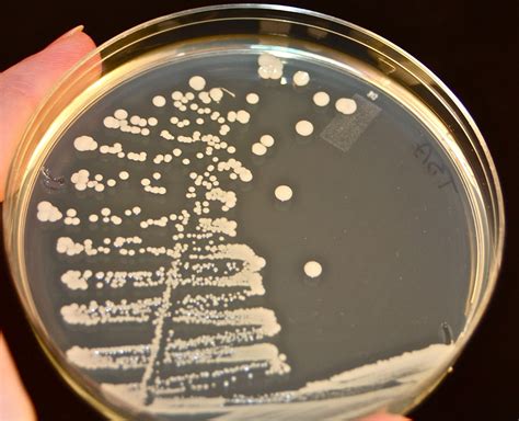 Bacterial Streak Plate
