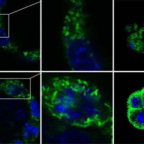 Mitochondrial Fusion Mfn1 Mfn2 And Fission Opa1 Mrna And Proteins