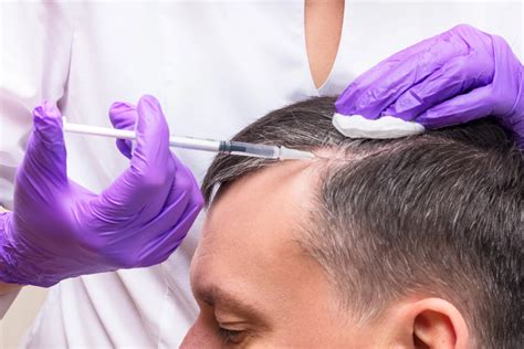 Hair Loss Restore Your Hair Today — Aesthetic Doctors Clinic