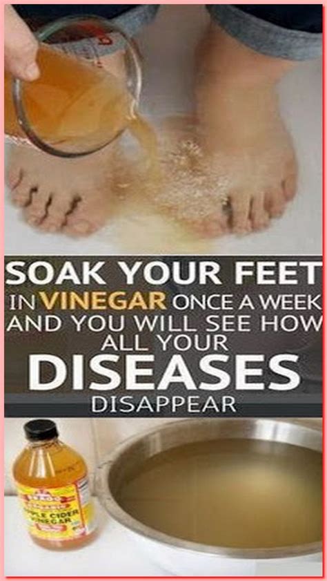 Soak Your Feet In Vinegar Once A Healthy Facts Health Healthy Tips