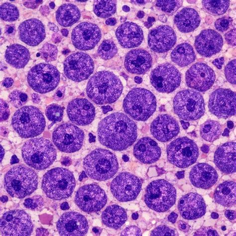 髄外性形質細胞腫 栄どうぶつ病院の公式ホームページ。栄どうぶつ病院は名古屋市中区栄の地域に根差したホームドクターを目指しています。