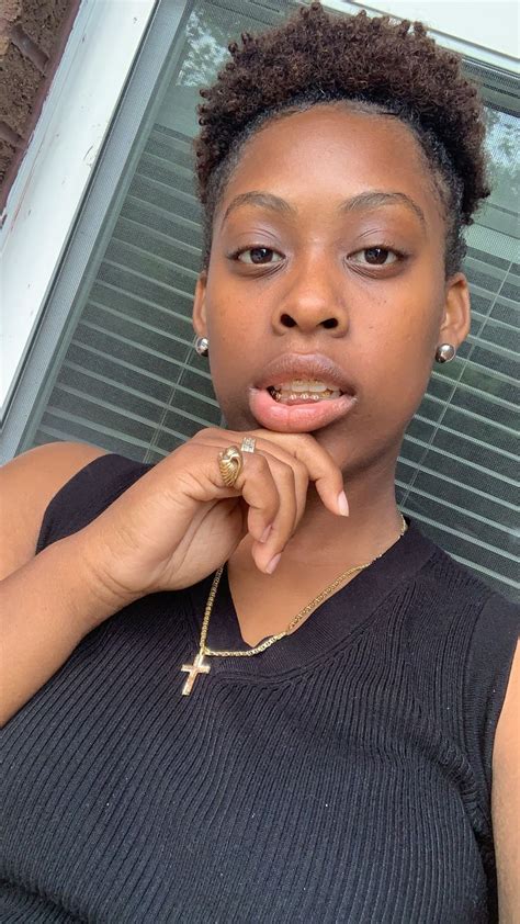 Braces Goldbraces Bgm Brace Face Gold Braces Face