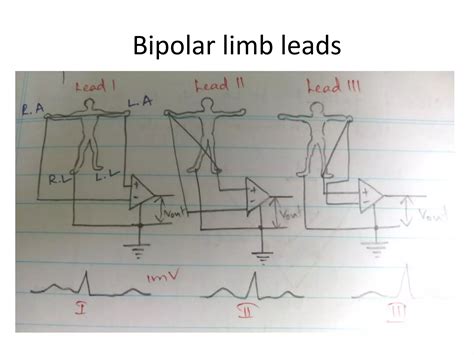Ecg Lead Configuration Pdf