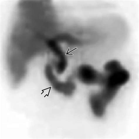 Imaging Approach To The Biliary System Radiology Key