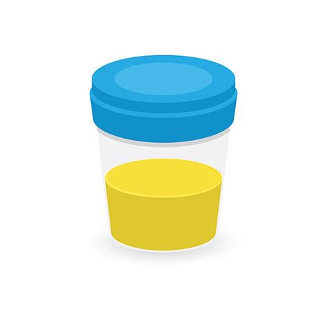 Urinalysis Illustrations Royalty Free Vector Graphics And Clip Art Istock