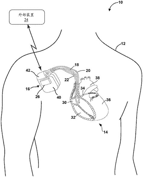电池组件的制作方法
