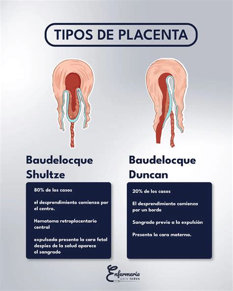 Majo Enfermería Para Todos La Expulsión De La Placenta 👩🏻‍⚕️🏥 Es La