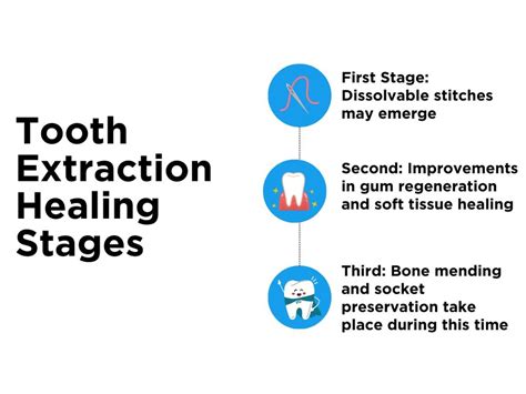 A Brief Guide On Tooth Extraction Healing Stages — Kwc Dental