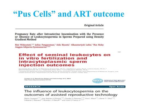 Male Infertility Panel Discussion By Dr Sujoy Dasgupta Pptx
