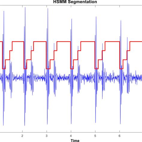 The Resulting Markov Chain In Pcg Segmentation Using Hmms Four