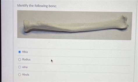Identify The Following Bone Tibia Radius Ulna Fibula