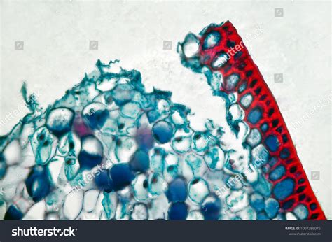 Needle Under Microscope At Marilyn Coulter Blog