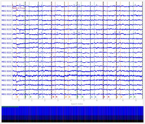 The Epochs Data Structure Discontinuous Data — Mne 1120dev37gff1092b42 Documentation