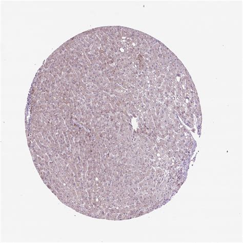 Tissue Expression Of Vdac1 Staining In Liver The Human Protein Atlas