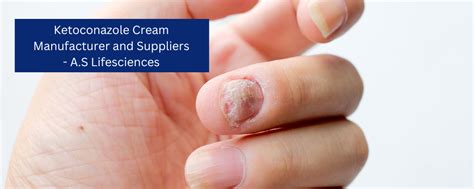 Ketoconazole Cream Manufacturer And Suppliers As Lifesciences