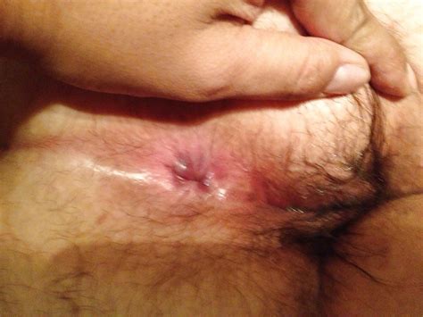 Wet Just Fucked Pussy Porn Pictures Xxx Photos Sex Images 1059862