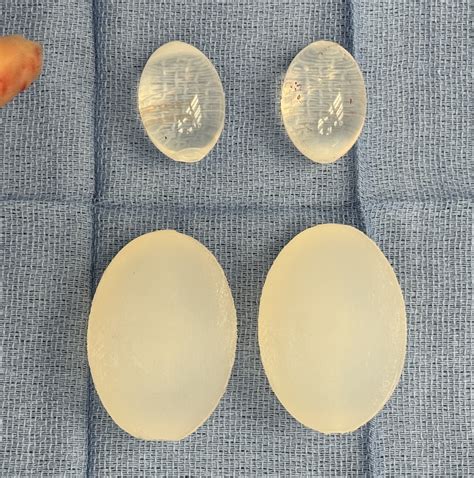 Silicone Testicle Implant Replacements For Saline Filled Implants