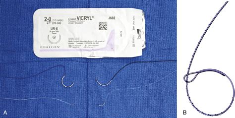 Suture Material Suturing Techniques And Knot Tying Clinical Tree