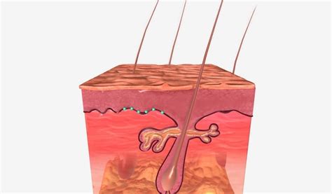 Premium Photo Anal Warts In Skin Tissue