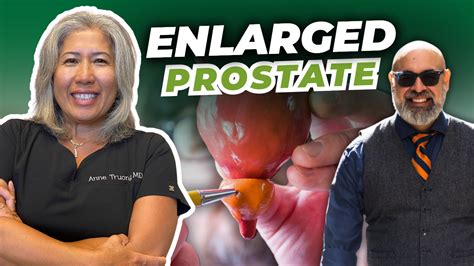 How Prostate Health Affects Sexual Function Dr Geo Espinosa